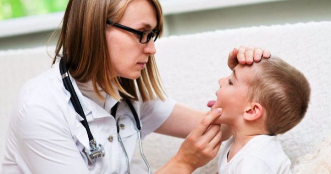 Torokgyulladás és mandulagyulladás: tünetek és kezelés gyerekeknél